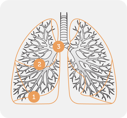 Autogenic Drainage – Respiratory Physiotherapy Ireland