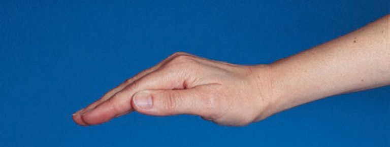 Manual Techniques – Respiratory Physiotherapy Ireland